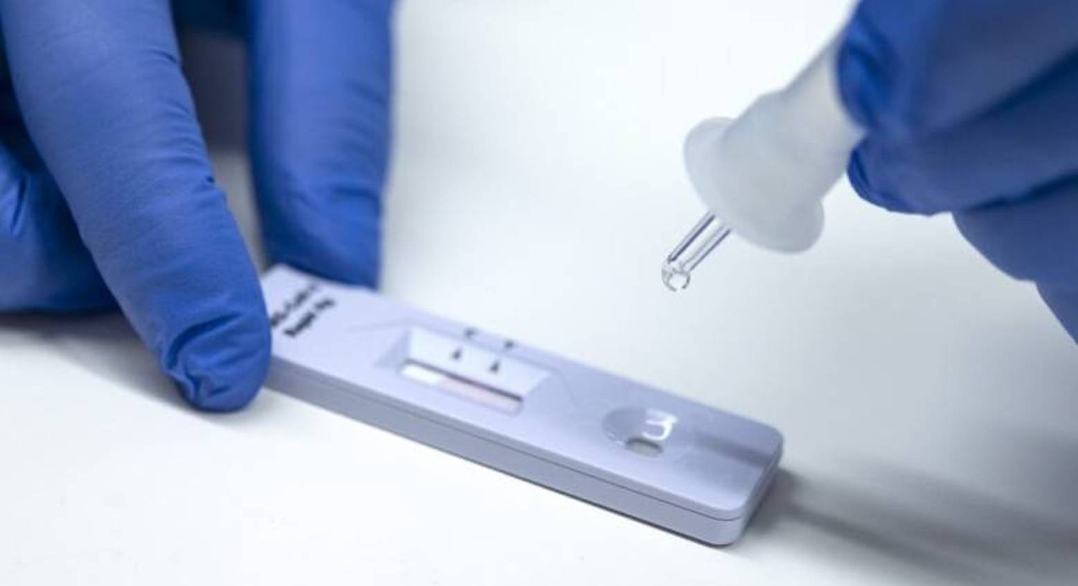 Αχαΐα: Τα σημεία που θα γίνονται δωρεάν rapid test σήμερα 19 Απριλίου ...